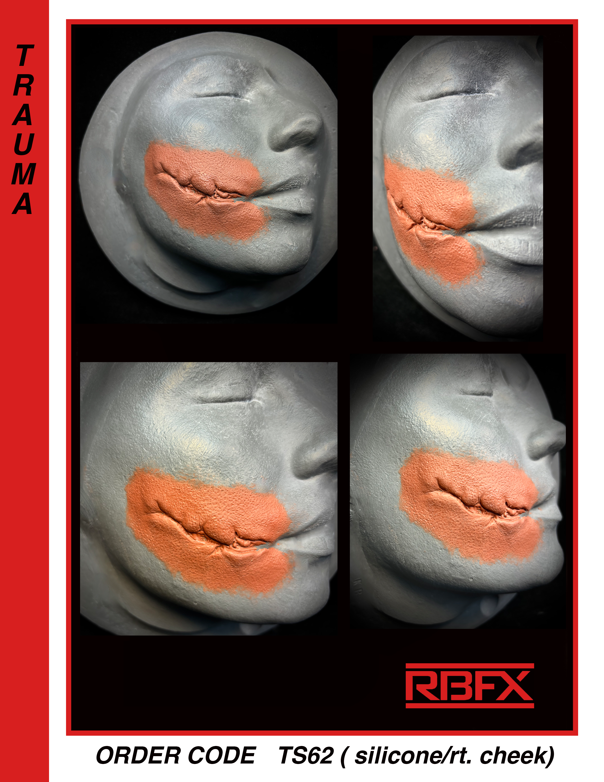 TS62 – Rt. cheek silicone gash | RBFX Studio